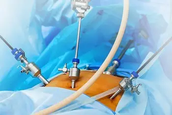 Лапароскопия, Эндоскопия в Бишкеке Кыргызстан - Ассоциация ...